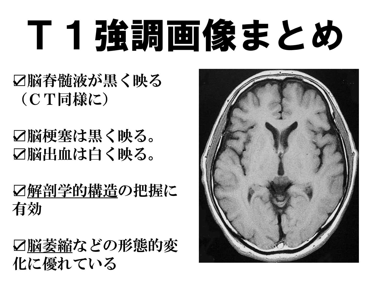 脳画像におけるCT・MRIの見方！！みるべきポイントさえ押さえれば、脳画像は簡単に見れる！！ | リハアイデア